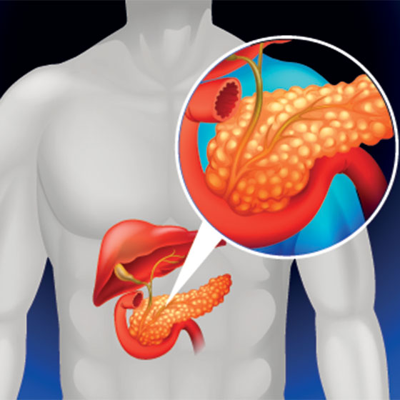 5 Alimente pentru PANCREAS sanatos